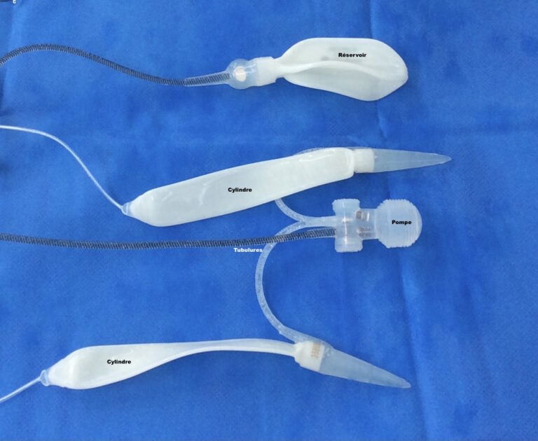 Implant pénien - Andrologie Paris